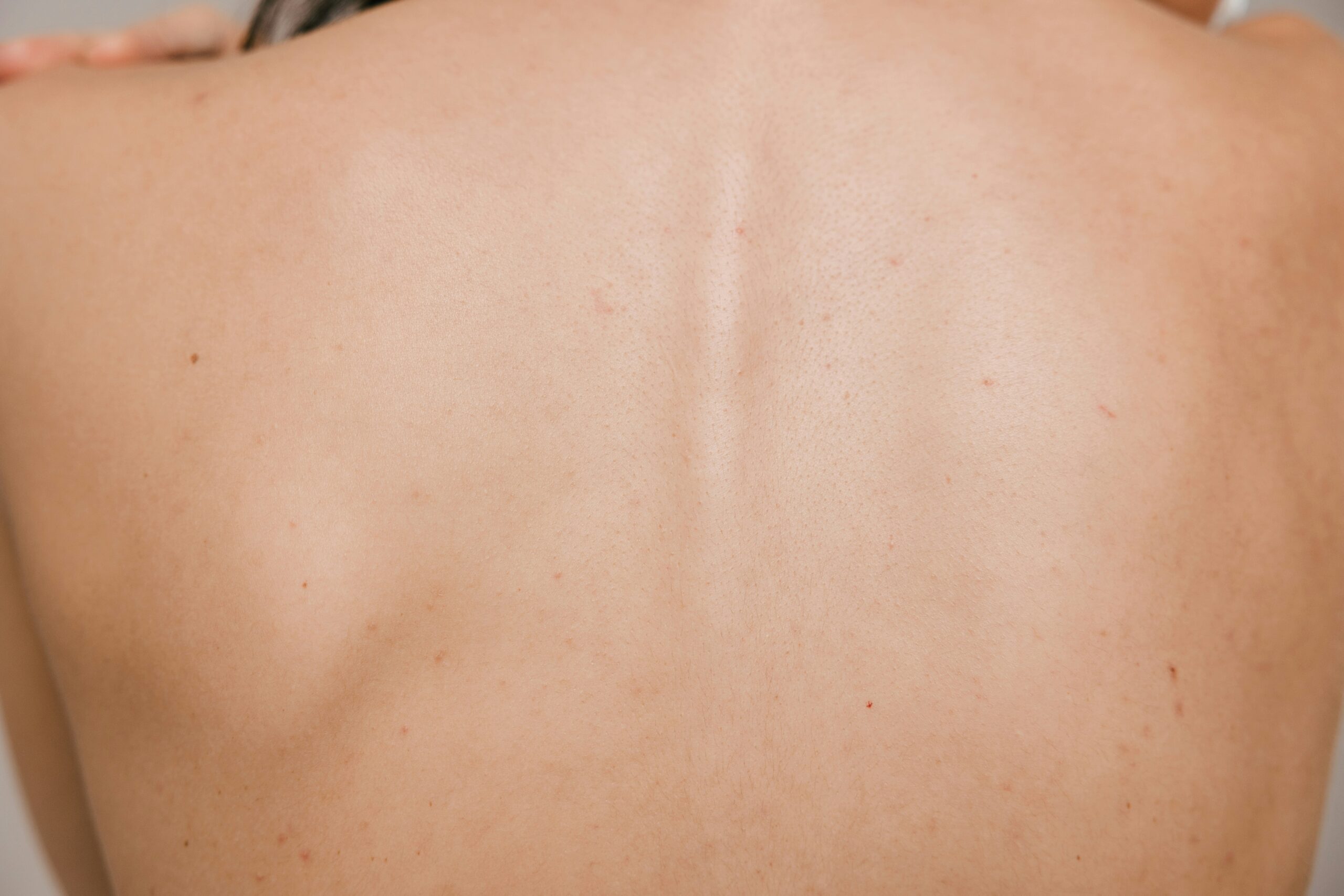 Skin tags, insulin and what your blood tests might be quietly telling ...